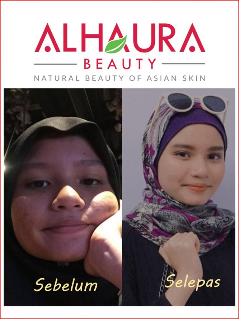 AlHaura Beauty – kosmetik berasaskan herba (kunyit) | produk selamat ...